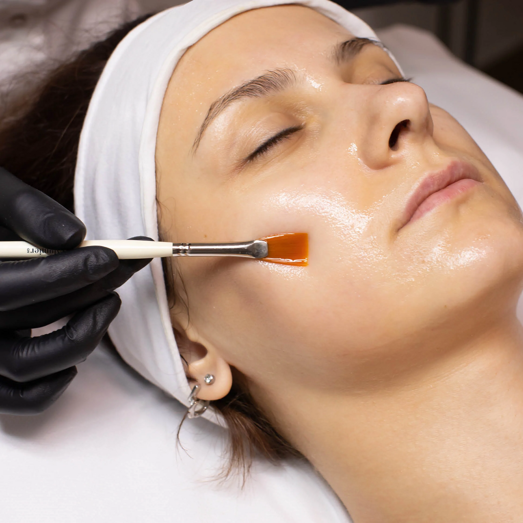 Professional Chemical Peels for Every Skin Concern | – AlumierMD UK
